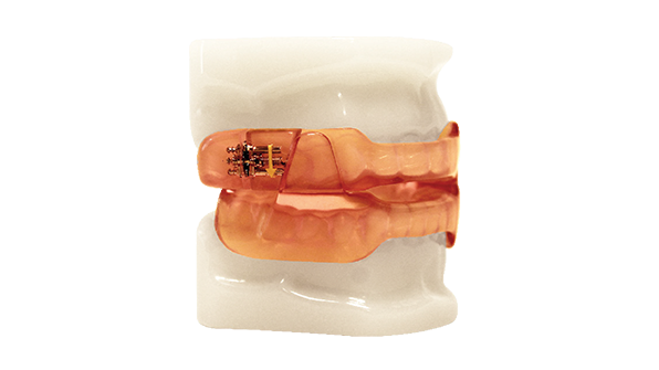 Schoonmaakinstructies voor uw MRA-beugel - Vivisol Nederland